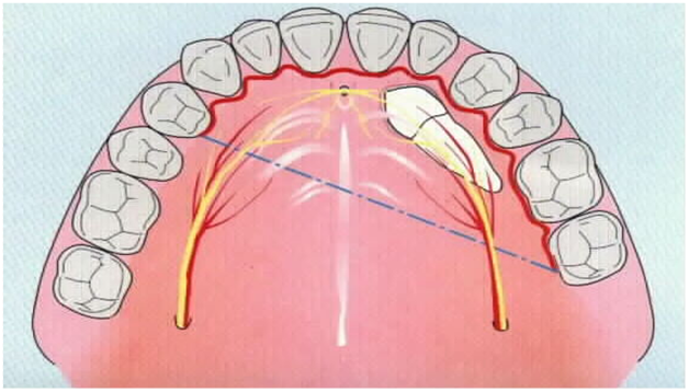 Dentistry and Medicine: Surgical management of Unerupted and Impacted teeth