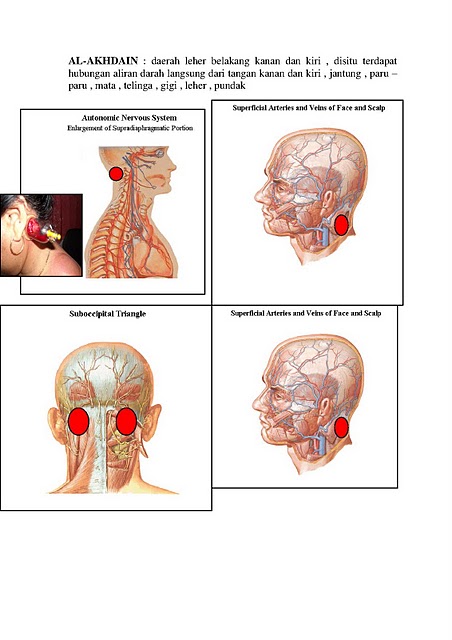 MAKLUMAT KESIHATAN DAN PENYAKIT: PERSAMAAN TITK BEKAM SUNNAH DAN TITIK ...