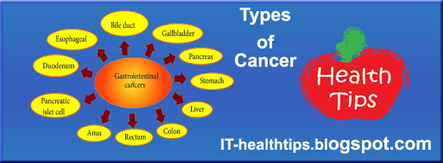 Types of Cancer ,10 types of cancer - Health Tips