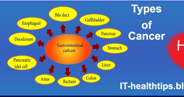 Types of Cancer ,10 types of cancer - Health Tips