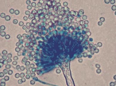Aspergillus versicolor ~ Microbio-Lab