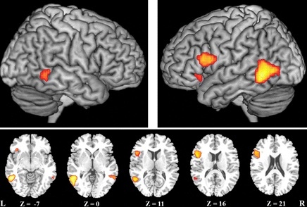 manouleskaipaidakia: Η ΜΑΓΝΗΤΙΚΗ ΤΟΜΟΓΡΑΦΙΑ (MRI)