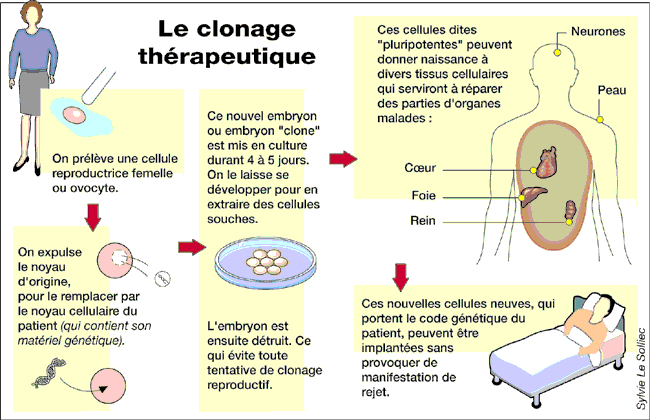 Clonage thérapeutique humain pour soigner un diabète de type 1