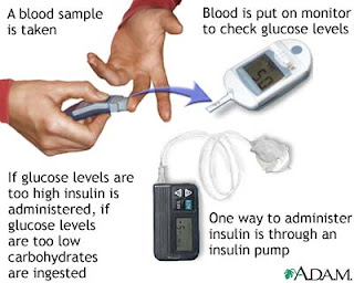 How to Test Your Blood Sugar at Home ~ Crazytechnoz