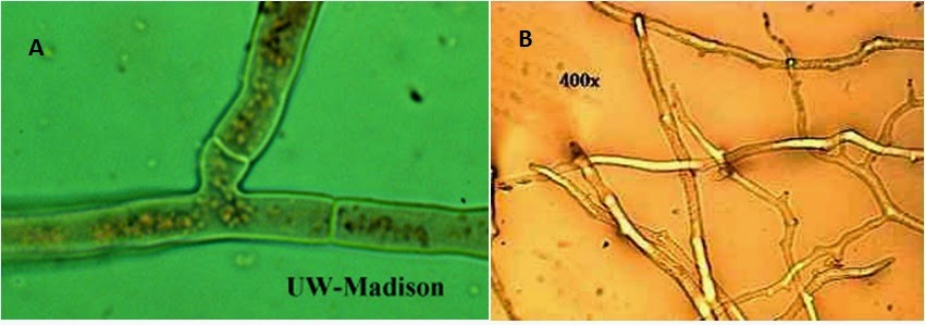 ciência: 101: Reino Fungi: Introdução e Características Gerais