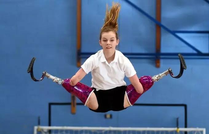 12-Year-Old Girl Without Limbs Wins National Trampolining Competition ...