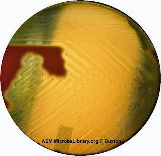 Blood Agar Plate Dan Uji Hemolisi