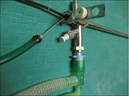 Medical Treatment Pictures-for Better Understanding: Bronchoscopy ...