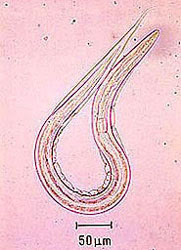 Uncinaria: julio 2013