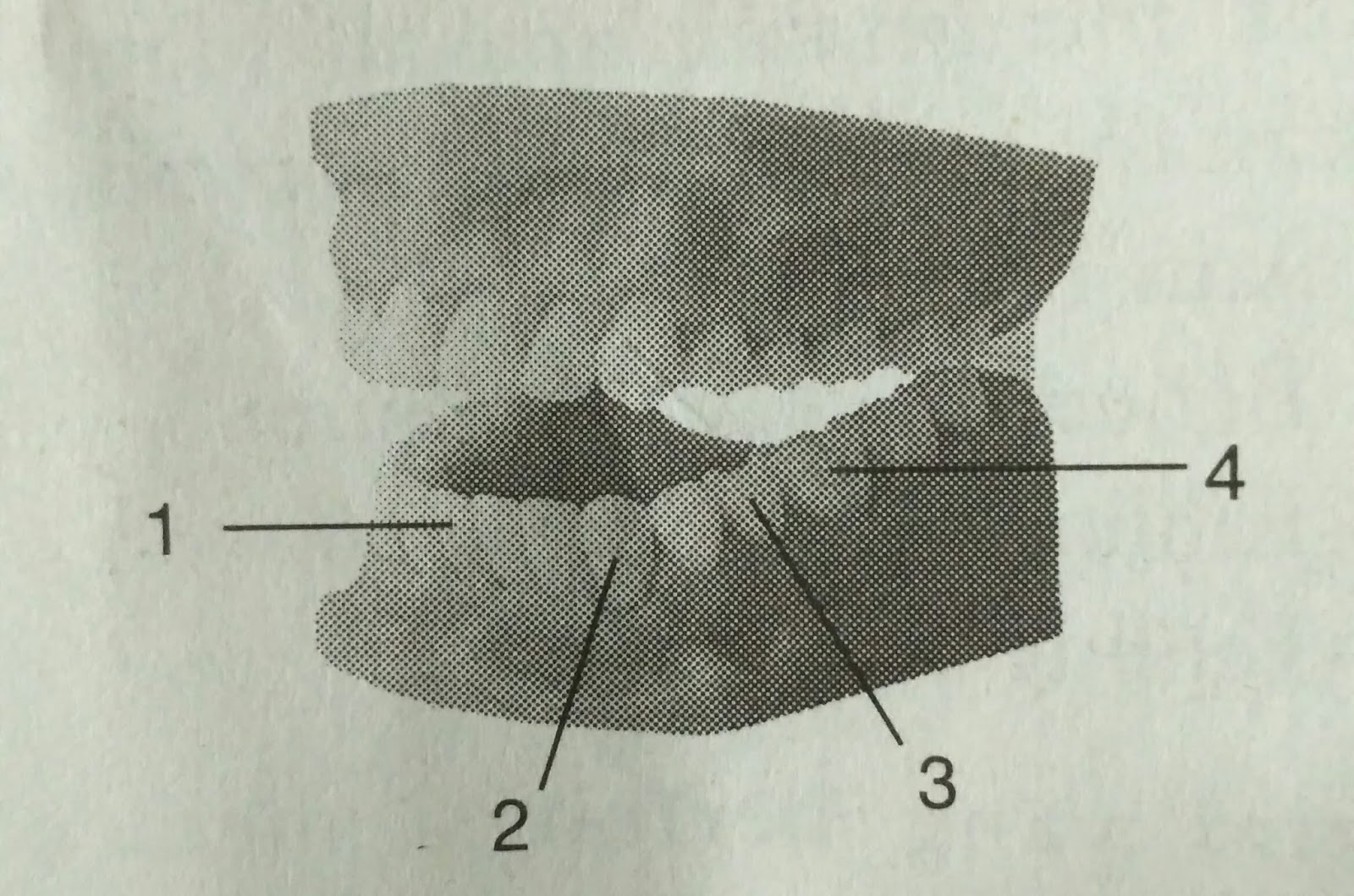 Latihan Soal Biologi Kelas 11 Bab Sistem Pencernaan Makanan Beserta ...