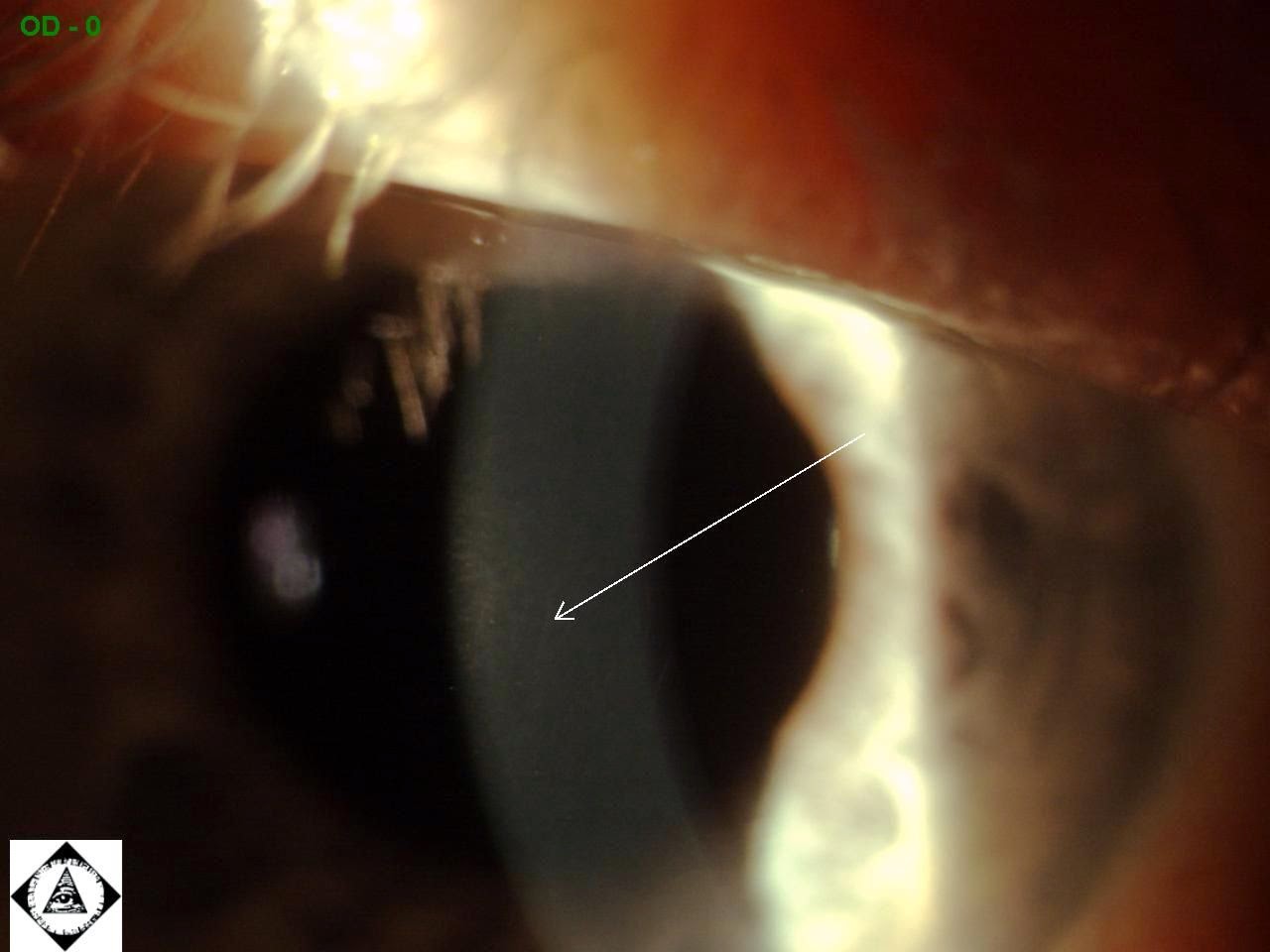 Sonoran Desert Eye Center: March 2014