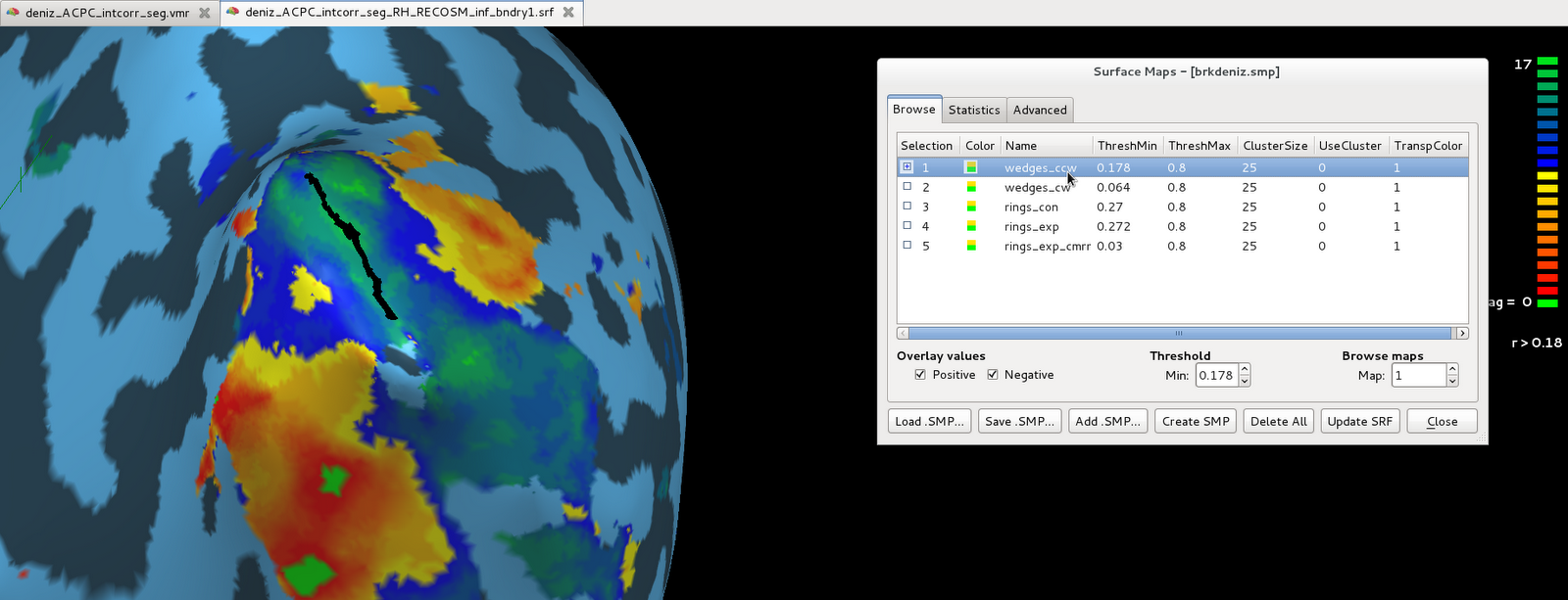 =Vision Group fMRI analysis guide=: Ring Stimulation with Single Shot ...