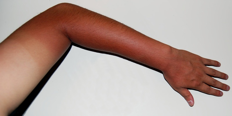 kitykicy ;): Kulit belang? atasi dengan tips ini!