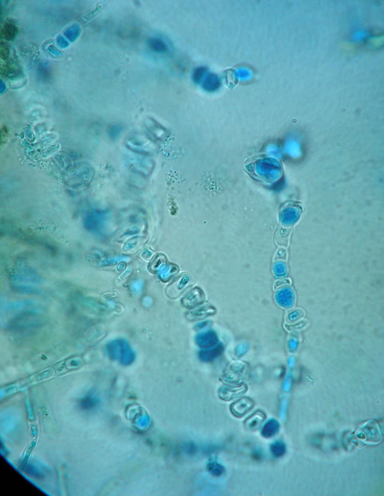 ATLAS MICOLOGIA: TRICHOPHYTON VERRUCOSUM