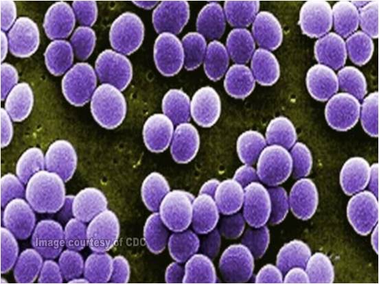 SENTHIL PRABHU SIVASAMY: Staphylococcus aureus