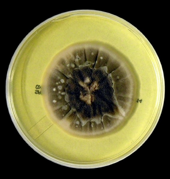 Fun With Microbiology (What's Buggin' You?): Sporothrix schenckii ...