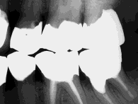 Dentistry and Medicine: Preparation of the Root canal System ...