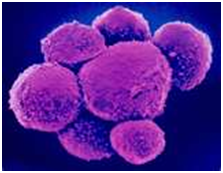 NOTA-NOTA PISMP PJ: Sistem limfa