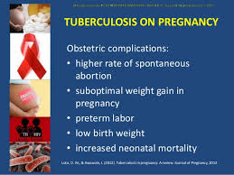 HEALTH & MEDICINE: Effect of Tuberculosis in pregnancy