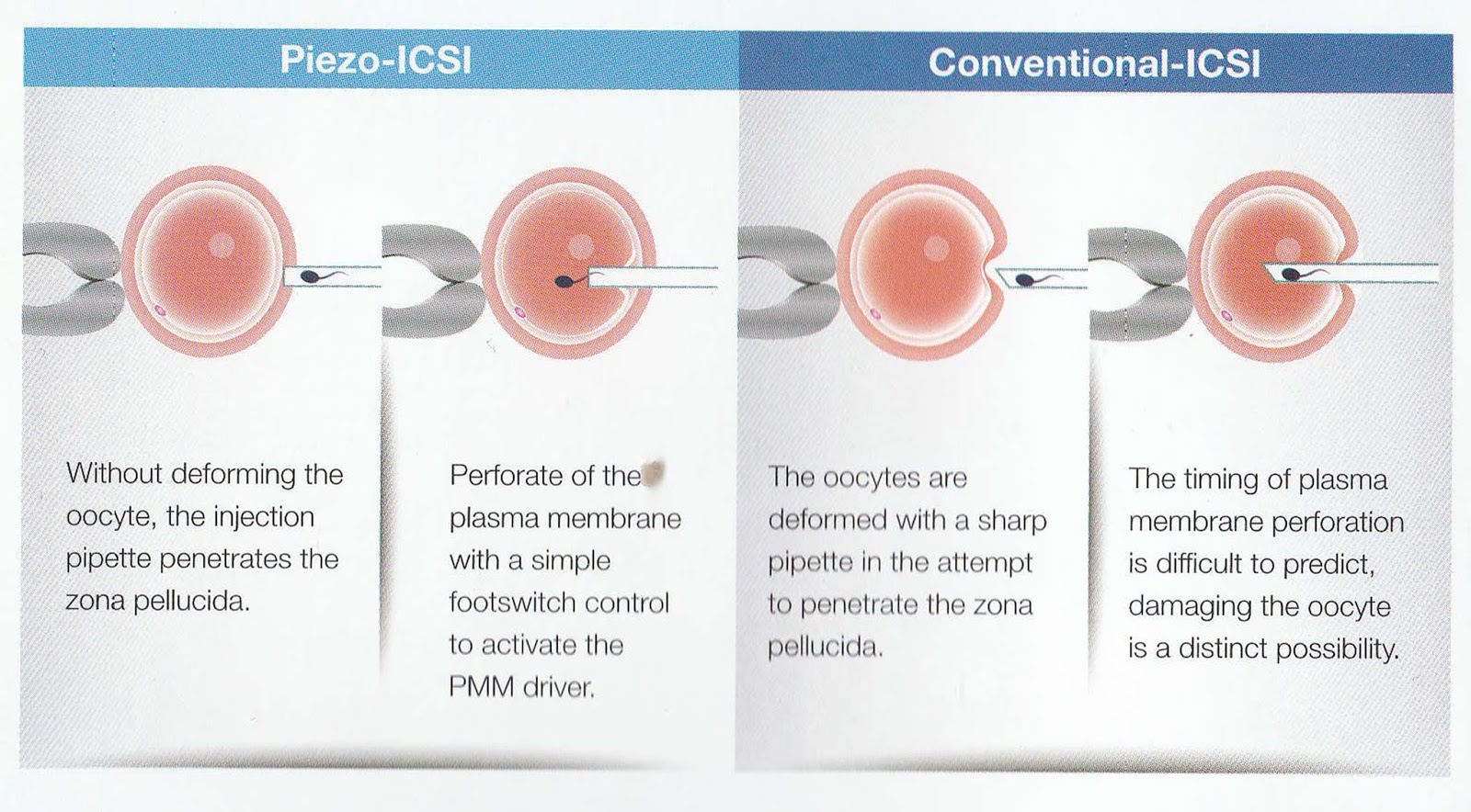 我的ivf试管婴儿の日记: 2018