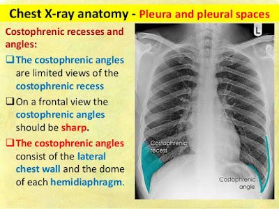 EXAMS AND ME : Angle