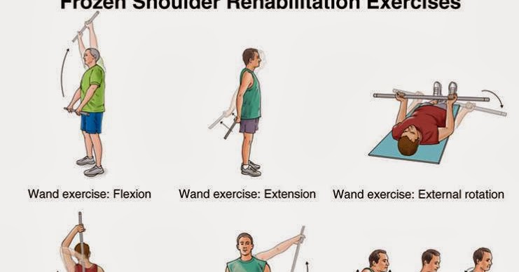 Physio Health: Frozen Shoulder Exercises