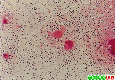 [Microbiology] Atlas of Streptococcus, Enterococcus, and Other Catalase ...