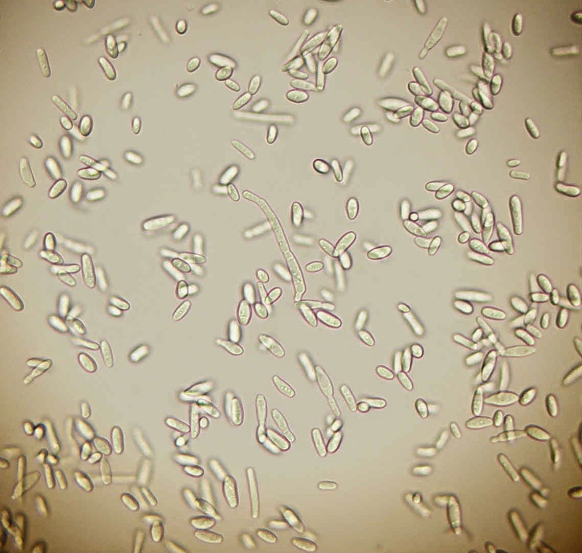 ATLAS MICOLOGIA: MAGNUSIOMYCES CAPITATUS