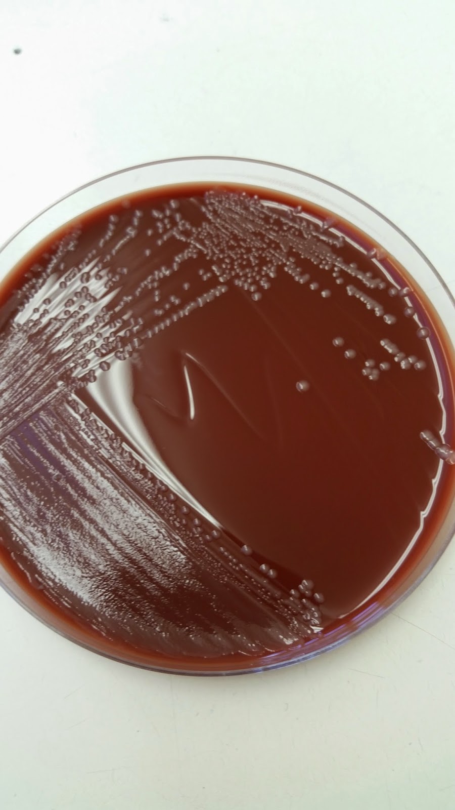 Microbiologylog: Salmonella spp. from Blood culture