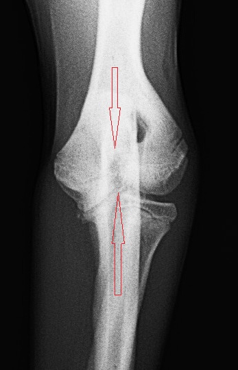 Traumatologia y Cirugia Ortopedica Veterinaria: Lateral process ...