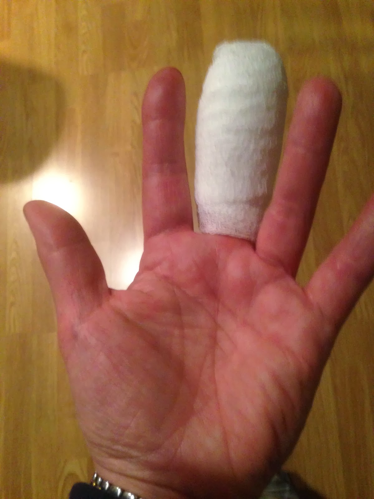 Hirnakan torppa: Missä on keskisormi?