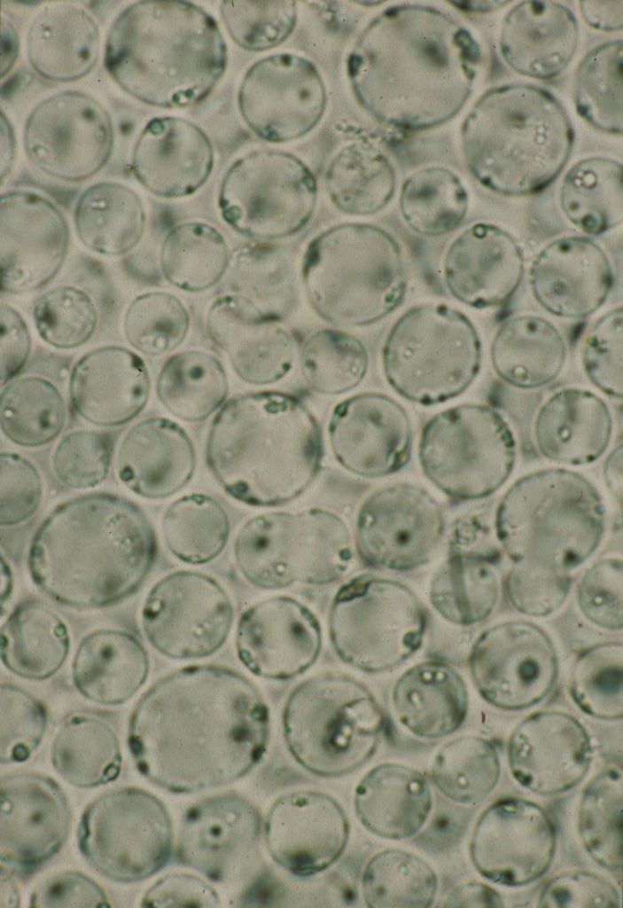 Blastocystis Parasite Blog: What is Blastocystis?