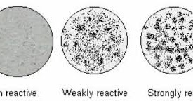 World Of Women: BIOLOGI DASAR MANUSIA RAPID PLASMA REAGIN(RPR) PADA SIFILIS