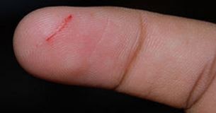 Physical and Technical Sciences - Free State: Why does a paper cut hurt ...