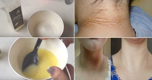 Remove Dirt And Darkness From Your Neck In Just 20 Minutes