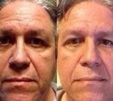 Getting Your Non-Invasive Facelift By Employing Facial Workouts: How ...