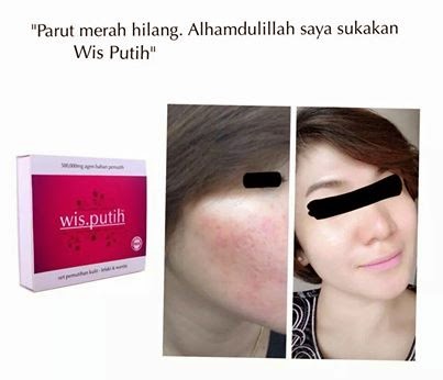 Produk Kecantikan & Kesihatan: WIS PUTIH SKINCARE FREE HYDROKINON