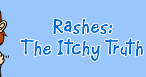 SKIN PROBLEMS/DISORDERS: RASHES