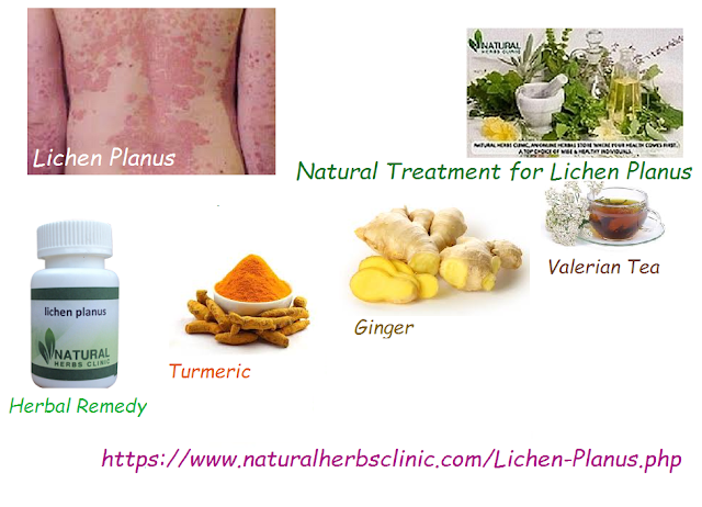 How Can Lichen Planus Be Prevented