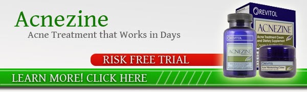 ACNEZINE - Acne Vulgaris Treatment That Works In days - Health Product ...