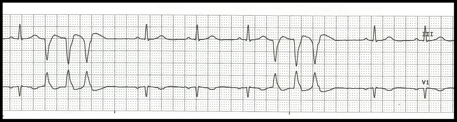 Basic EKG Rhythm Test 12
