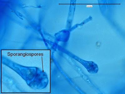 Fun With Microbiology (What's Buggin' You?): Apophysomyces elegans ...