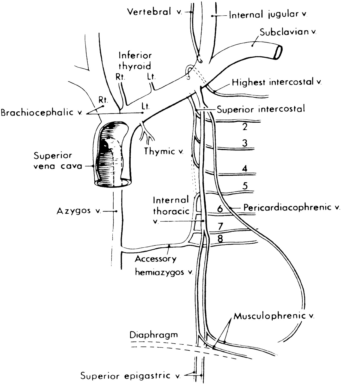 Pedi cardiology: Innominate vein tributories