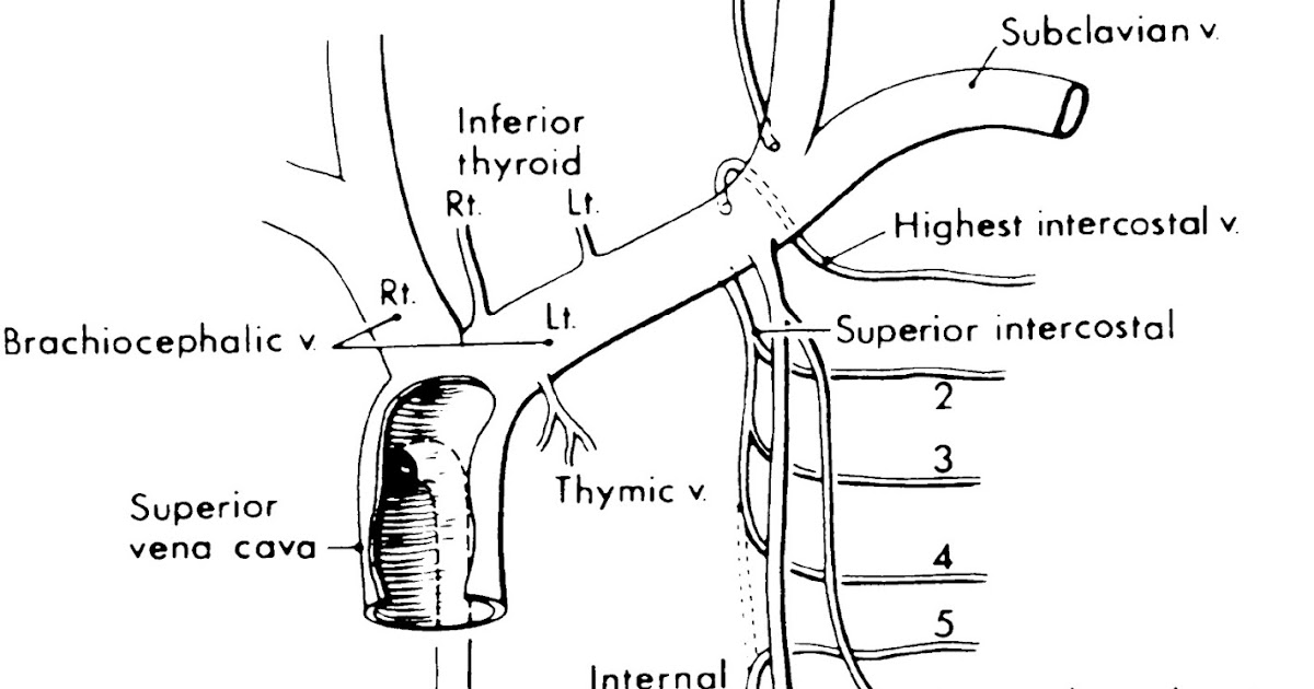 Pedi cardiology: Innominate vein tributories