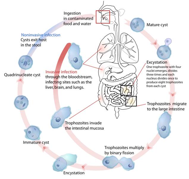 Infectious Diseases: Gastrointestinal tract: Amoebic Dysentery