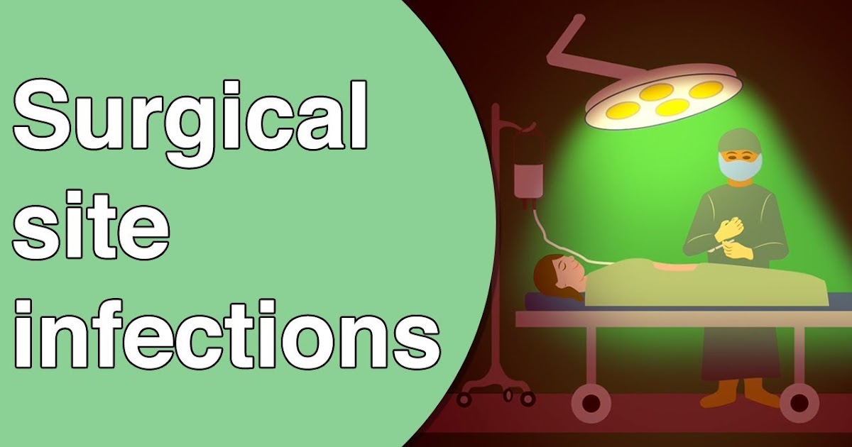 Ob/Gyn Updated : ACOG guidance on prevention of surgical-site infection ...