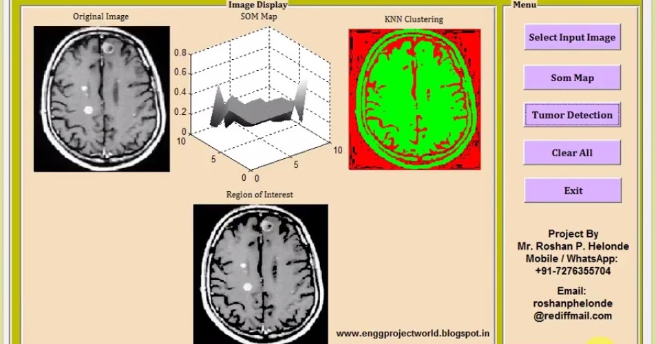 Brain Tumor Detection And Classification Using Clustering And Segmentation Matlab Project With