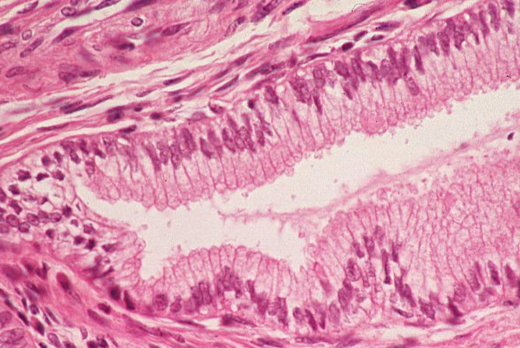 Extended Practice : Pink Ink || Pink cells || Image inspiration