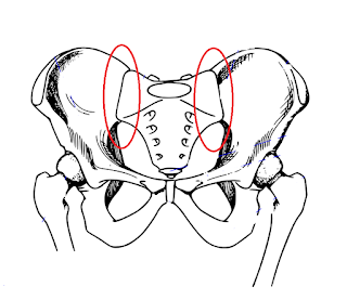 SACROILIAC JOINT DYSFUNCTION