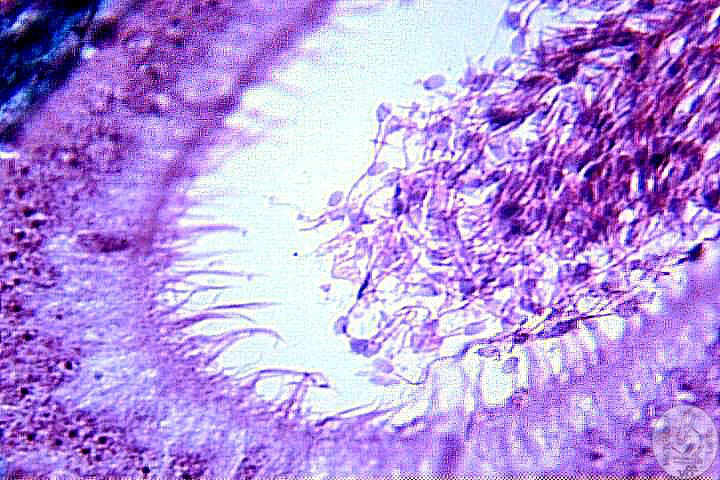 Monitoria de Histologia Uninassau: Epidídimo